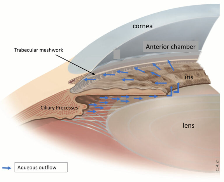 Selective Laser Trabeculoplasty (SLT) for Glaucoma | Eye Associates ...