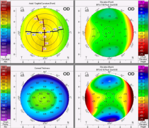 Advanced Eye Imaging Seattle | Ophthalmologist Seattle, WA