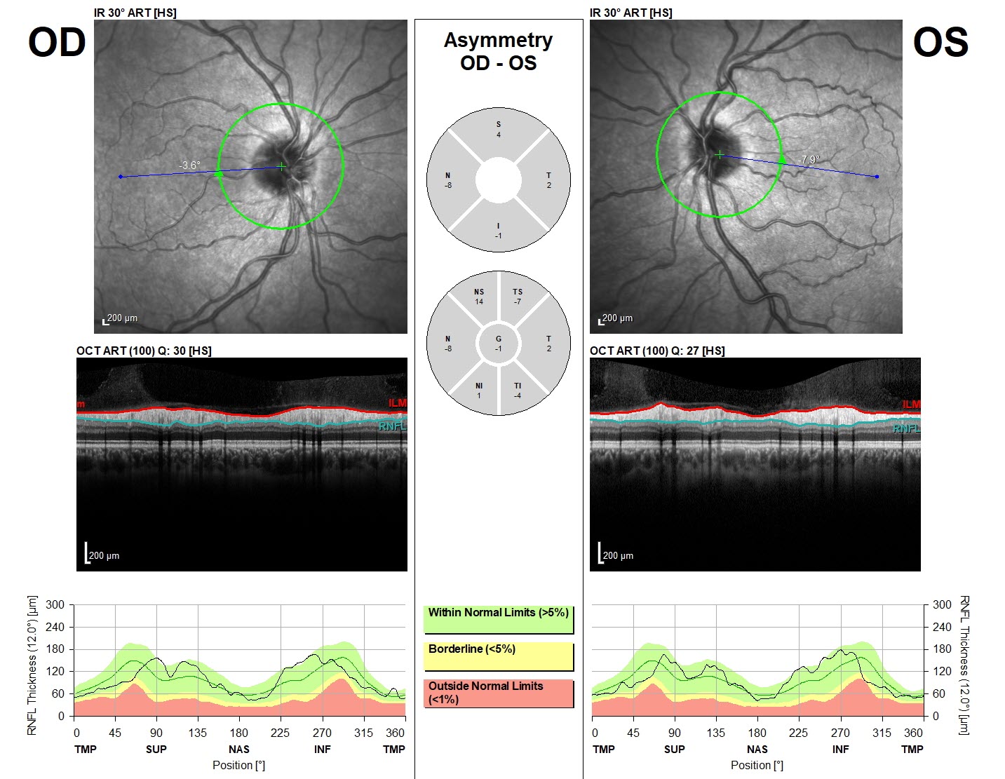 Advanced Eye Imaging Seattle | Ophthalmologist Seattle, WA
