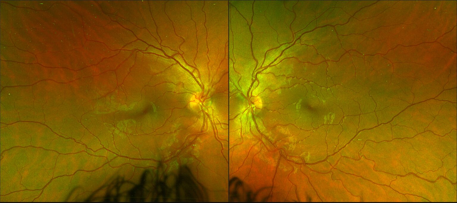 Advanced Eye Imaging Seattle | Ophthalmologist Seattle, WA